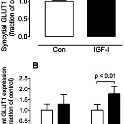 IGF-I and GLUT1 expression in primary syncytial cells and placental ...