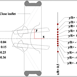 Schematic of the valve and points of interest upstream and downstream ...