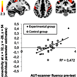 Relationship AUT-scanner fluency at-pre-test and right middle temporal ...