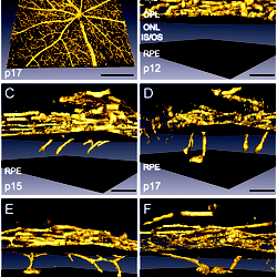 Neovessels originate from the INL and grow towards the RPE in NRV2 mice.