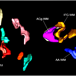 Short range WM regions in top and left view.