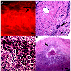 Abdominal serositis.