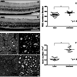 RGC and optic nerve axonal damage following IOP elevation.