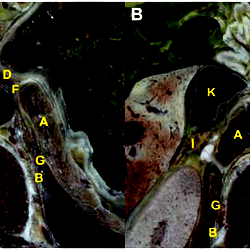 Visualization of the anatomic location of retrocrural space across ...