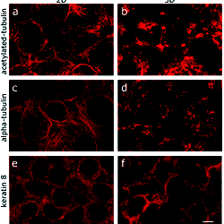 Immunohistochemical staining of tubulin and keratin.