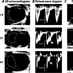 Confirmation of PAH by echocardiography.