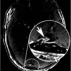 This figure shows the scan of a 58-year-old male patient (subject 11 ...