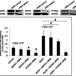 Effects of siRNA knockdown of WAVE1/2 and N-WASP in PDGF-induced ...