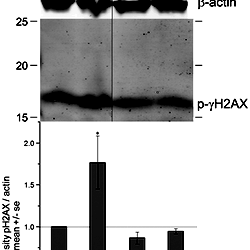 Western blot with corresponding quantification reveals DXR-induced ...