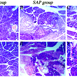 Representative photographs of HE stained pancreas.
