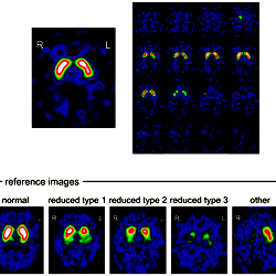 Example page from the pdf document for visual scoring.