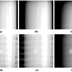 Radiographic images of chest phantom.