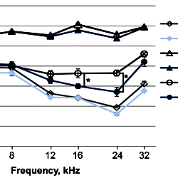 ABR threshold shifts.