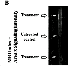 Magnetic resonance imaging (MRI) data analysis of intervertebral disc ...