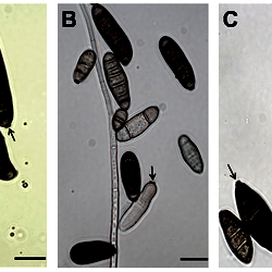 Conidia of (A) clinical isolate of E. rostratum, (B) Bipolaris sp. (C ...