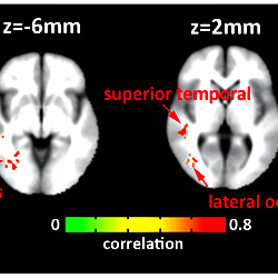 Whole brain correlation map showing regions that exhibit a significant ...