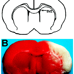 Infarct volume assessed by TTC staining 1 day after the tMCAO.