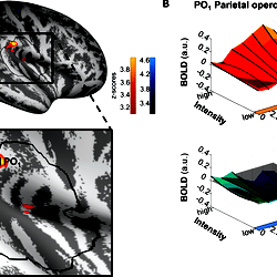 The parietal operculum preferentially encodes heat pain and not ...
