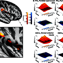 The parietal operculum preferentially encodes heat pain and not ...