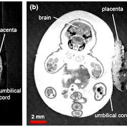 Coronal sections of in amnio mouse embryo MR images at E17.5.
