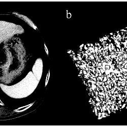 Representative 3D MDCT images of the L3 vertebra obtained from a 71 ...