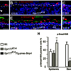 Transgenic pmes-Bmp4 reactivates Smad1/5/8 signaling in the dermal ...