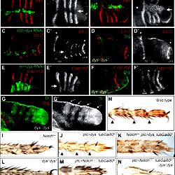 dys relationship with the Notch pathway.