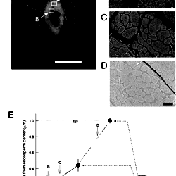 Transverse sections of a typical ring-shaped chalky kernel (A); and ...