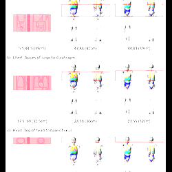 How have advances in CT dosimetry software impacted estimates of CT ...