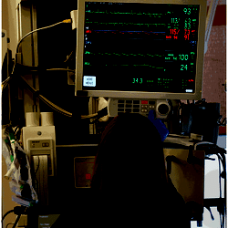 Physiologic monitor device in Intensive Care Unit.