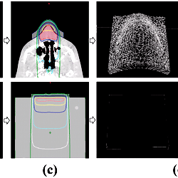 Schematic illustration of the procedures for 3-dimensional (3D ...