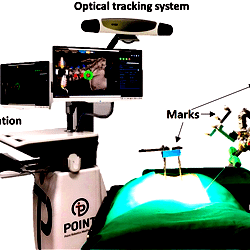 Point spine navigation system (PSNS).