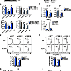 ACC1 controls acetyl-CoA production and MHC-I/IL-7 expression in DC.