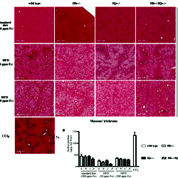 High fat diet does not promote liver fibrosis in mouse models of ...