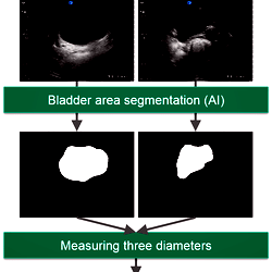 Methodological overview: Automated bladder volume measurement.