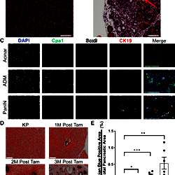ADM and PanIN lesions precede tumor formation in KPT mice.