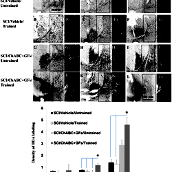 Synergistic effects of ChABC, GF and daily exercise enhance the ...