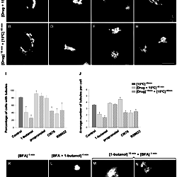 Effects of inhibitors in the formation of low temperature- and BFA ...