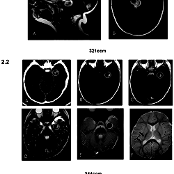 1–3 MRI/TC scans from subjects