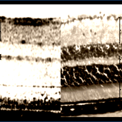 Cross-sectional views of the C57BL/6 mouse retina by SD-OCT (left) and ...
