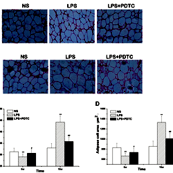 Prenatal exposure to LPS alters of adipose cell size in 6 (A) and 16 ...