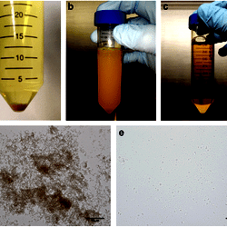 Images and microscopy of urine crystal precipitation and dissolution.