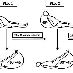 Serial passive leg raising (PLR) maneuver protocol.