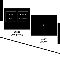 Illustration of the delay-discounting task procedure.