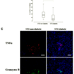 Infiltration and cytotoxicity of STZ-diabetic CTLs in tumor.