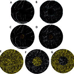 Methods for calculating VD, BFA, and FAZ from en face OCTA images.