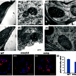 Morphological analysis of mitochondria in wild-type (WT) and mterf15 ...