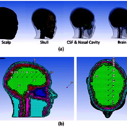 Finite element head model showing (a) progressively more internal ...
