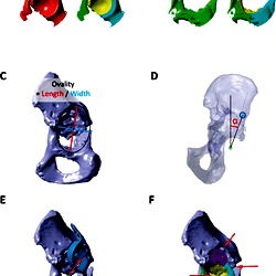 Defect analysis parameters.