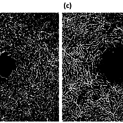 OCT-A images of the macula with superficial vascular plexus (SVP, a ...